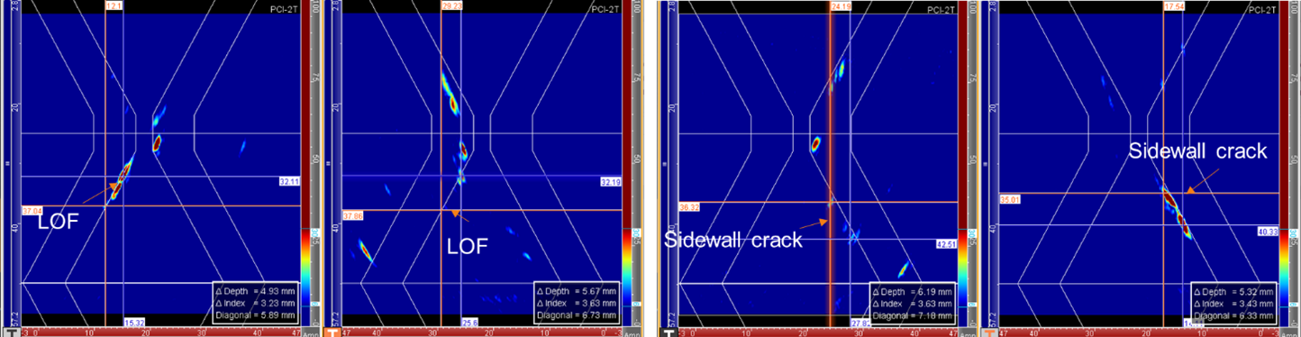 The Pros and Cons of Phase Coherence Imaging (PCI)