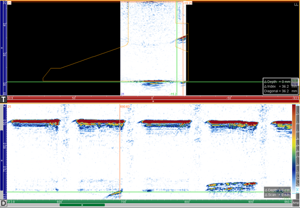 What You May Not Know About the LYNCS™ Advanced Ultrasonic Scanner